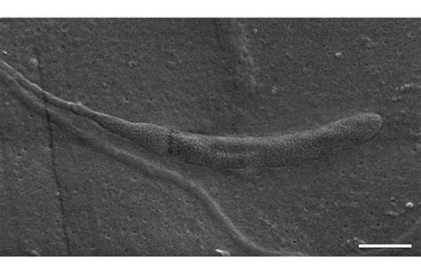 Antarctic Expedition Finds Worlds Oldest Sperm Cells