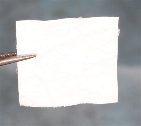 Остеопластика — всего одна операция. — IMPLANT-IN.COM — дентальная ...
