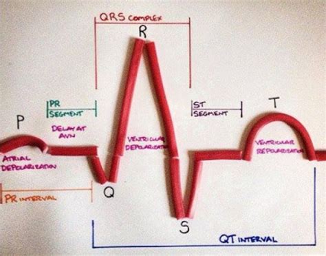 10 Steps To Learn Ecg Interpretation Artofit