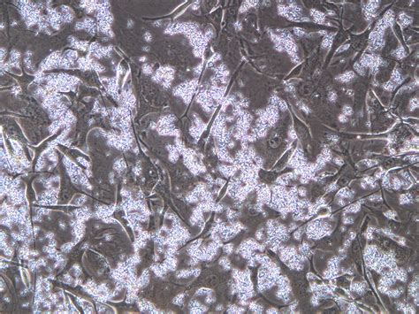 Sources Of Yeast Contamination In Cell Culture At Bryan Riggs Blog