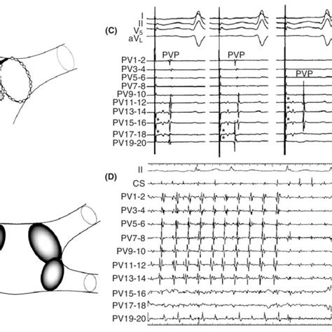 A And B Schematic Drawing Of The Electrical Pv Isolation Procedure Download Scientific