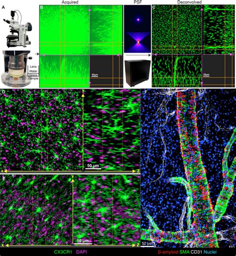 Depth Variant Deconvolution Applied To Widefield Microscopy For Rapid