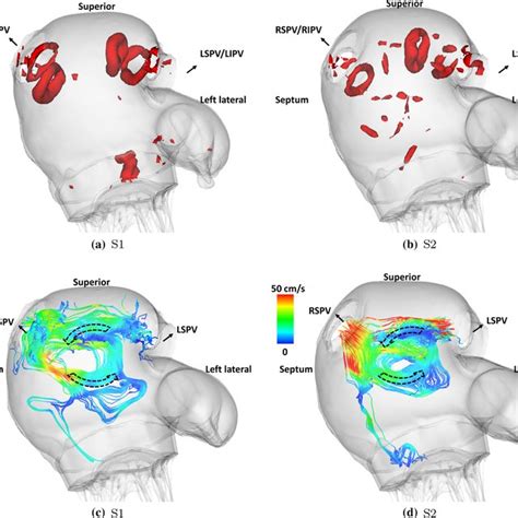 Vortex Core Detected Using The So Called Lambda2 Method During A S1 Download Scientific Diagram