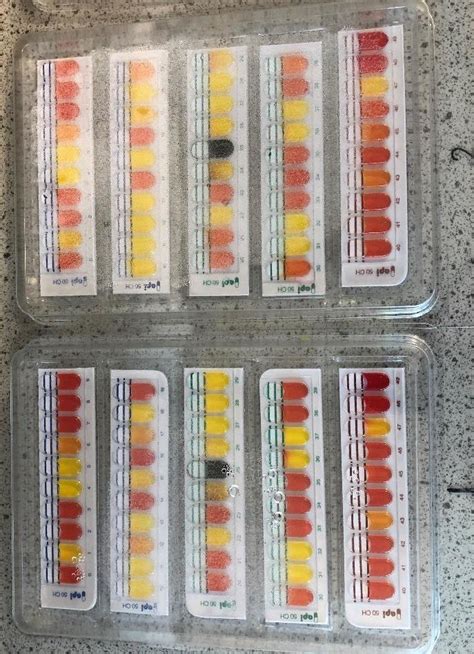 Soil Samples Subjected To API 50CHB Kit After Incubation A Incubation Download Scientific