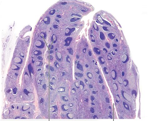 Histology Of Palatine Tonsil Diagram Quizlet