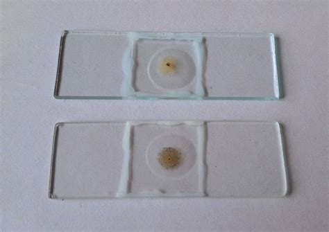 Eugene Kopilov On Linkedin Long Term Trichoderma Preparation