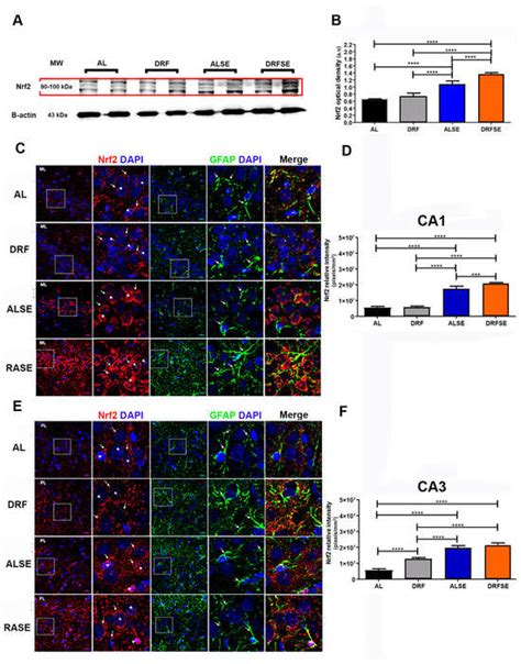 Brain Sciences Special Issue Recent Advances In Pathophysiology And