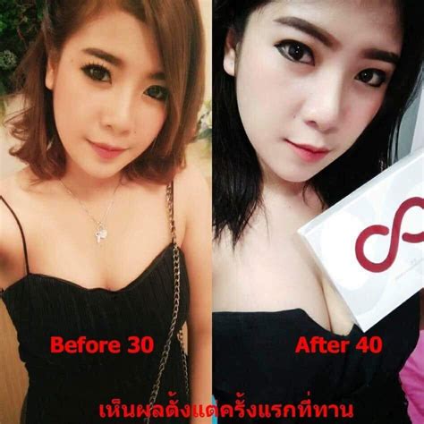 💥 💥ผู้หญิงที่กำลังประสบปัญหาอกเล็ก หอยไม่ฟิต ปวดประจำเดือน ตกขาว หรือรู้สึกไม่มั่นใจเวลามี