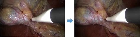 Figure 1 From Deep Learning Based End To End Specular Reflection