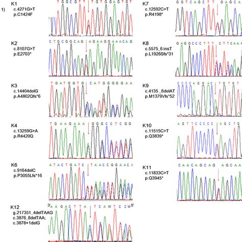 Partial Sequences Of Kmt2d And Kdm6a Showing The Mutations Detected In Download Scientific