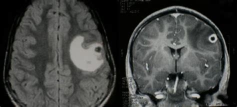 Imagenología De La Cabeza Y El Cerebro Concise Medical Knowledge