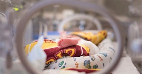 Harlequin Ichthyosis Definition Symptoms Treatment And Prognosis