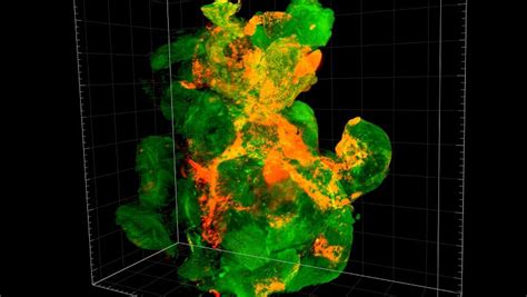 Nanoparticles For Optimized Cancer Therapy Statnano