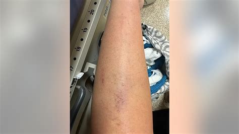 Mom Of American In Bahamas Sex Attack Says Daughter Texted Weve Been
