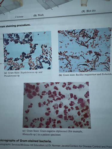 Gram Staining Flashcards Quizlet