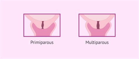 Cervix Early Pregnancy
