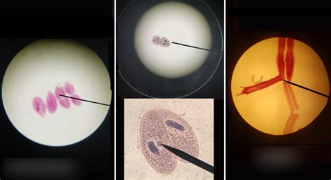 Exercise Propogation Diagram Quizlet