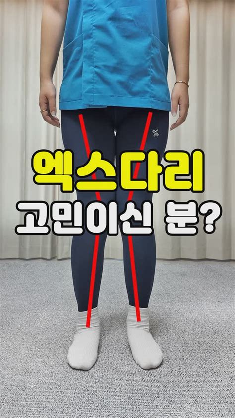 🔥퇴행성 관절염 무릎 통증🔥 무릎이 아픈 사람 일어날 때 계단에서 곡소리 나는 사람 무릎 퇴행성 관절염 의심되는 사람