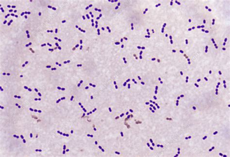 Streptococcus Bacteria Stock Image B236 0145 Science Photo Library