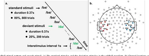 Figure 1 From Features Of Beta Gamma Phase Amplitude Coupling In Cochlear Implant Users Derived