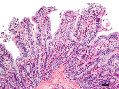Histological Evaluation Of Intestinal Tissue At Time Zero Moderate