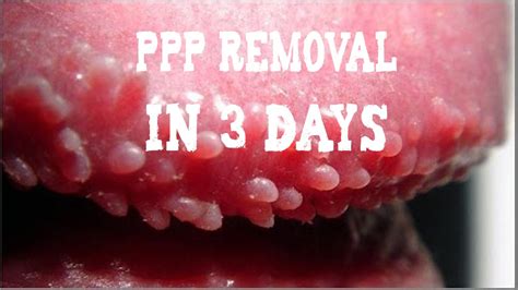 Bumps On Dick Pics Pics And Galleries