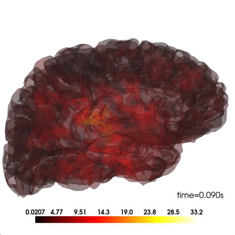 Plotting With Mne Viz Brain MNE Documentation