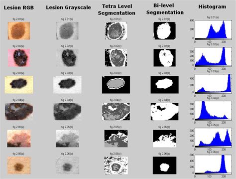 tetra level segmentation results download scientific diagram