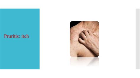 Skin Rashes Red Flag Symptoms Ppt