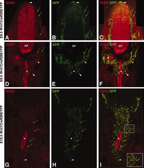 Sox2 Expression Is Downregulated In Early Migratory Enteric Neural Download Scientific Diagram