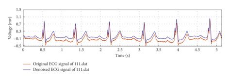 Ecg Signal Denoised By Db6 Wavelet Download Scientific Diagram