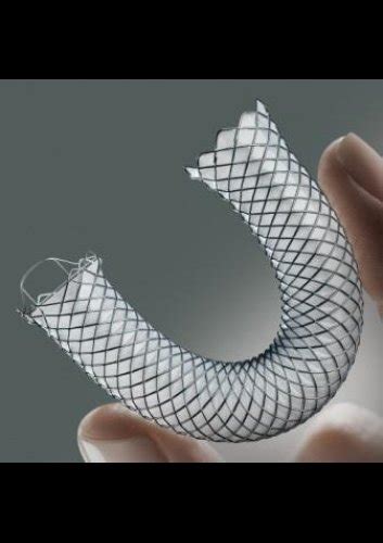 Стентування периферичних артерій