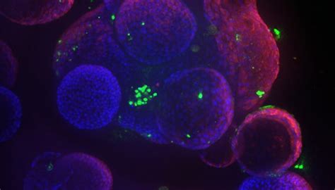 Cellular Imaging Systems Video Gallery