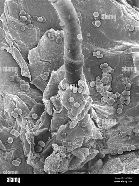 Scanning Electron Micrograph Sem Of Photocomposite Staphylococcus Aureus On The Surface Of