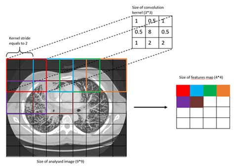Deep Learning Convolutional Neural Networks For Medical Image