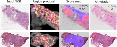 two examples of region proposal generation and detection results top