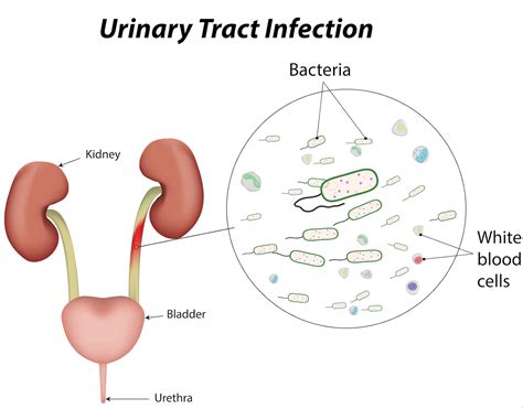 Proteus Meaning Iumloxa