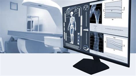 X Ray In Chennai 100 Best Diagnostic Centres