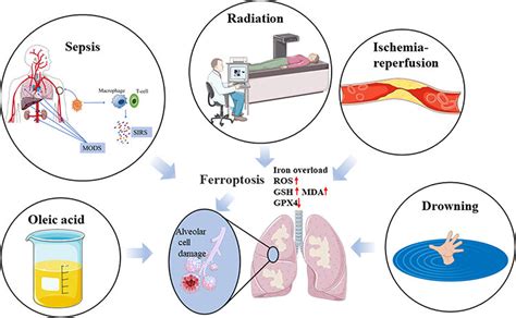 Ferroptosis Is Associated With Ali Caused By Ischemia Reperfusion Download Scientific Diagram