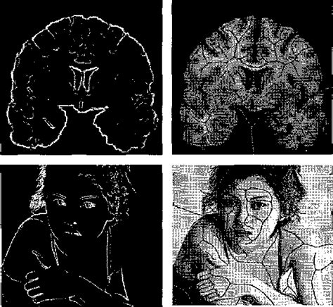 Topological Skeleton Semantic Scholar