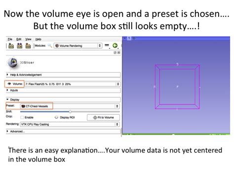 Navigating 3d Slicer 101 Basic Introduction To Slicer Software And