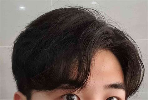 지금 리프컷 3달안에 가능함