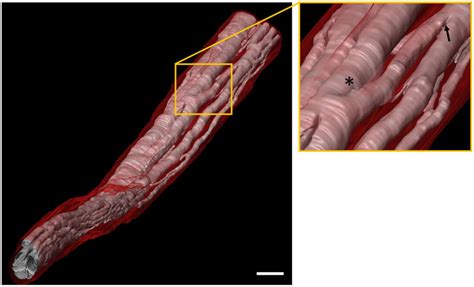 Surface Rendering Based Visualization Of Fascicular Anatomy Of A Download Scientific Diagram