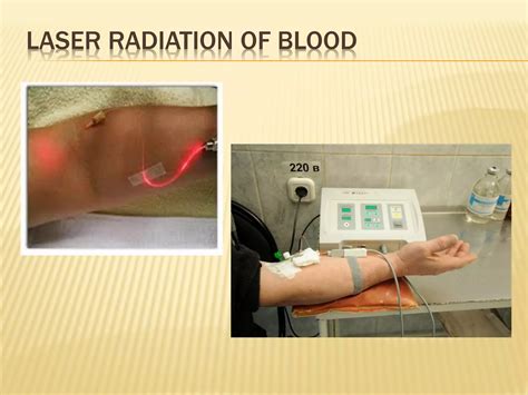 Antisepsispdf Free Download