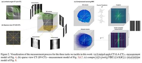 Cvpr 2023 把扩散模型应用到3d医学图像重建！diffusionmbir：使用预训练2d扩散模型求解3d逆问题 知乎