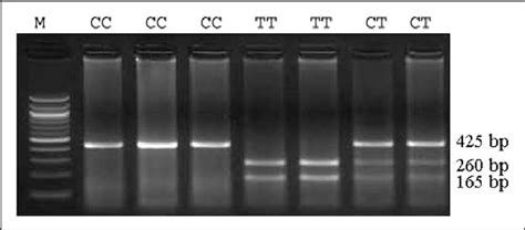 Mthfr C677t Mutation Was Detected By Polymerase Chain Download Scientific Diagram