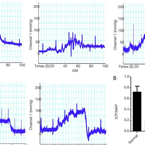 Comparison Of Erectile Functions Among Groups A Representative