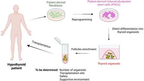 Stem Cells Technology For Thyroid Transplantation Personalized