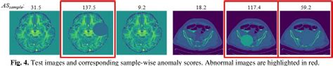 Figure 4 From Anomaly Detection Through Latent Space Restoration Using