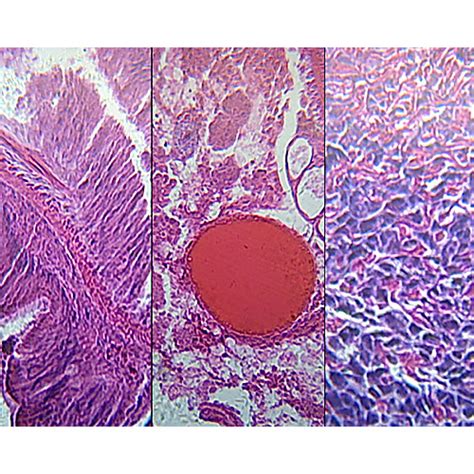 Prepared Microscope Slideearthworm Composite Cs Section Through
